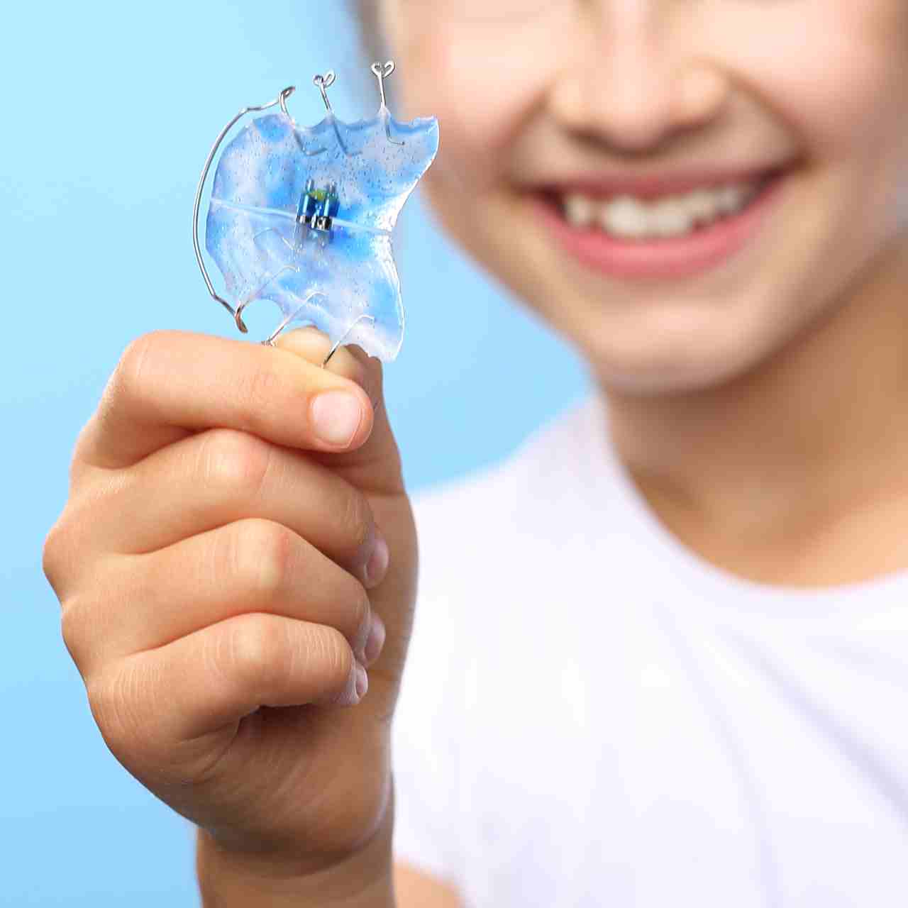 Tipi di apparecchio ortodontico: breve guida dalla A alla Z!